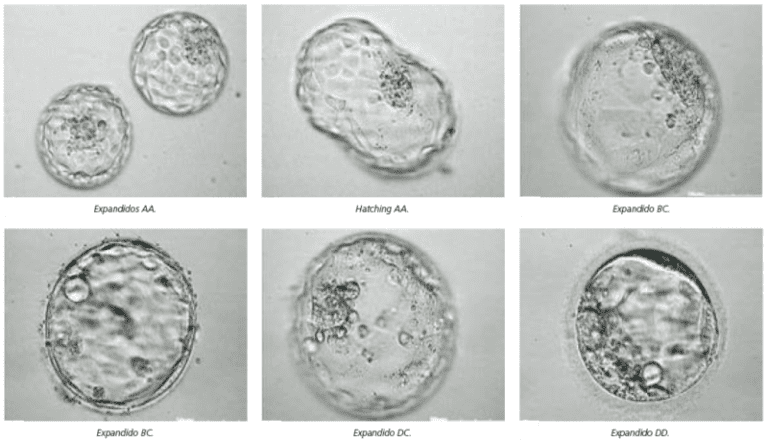 ¿Qué es un Blastocisto y cómo se clasifican según su calidad?