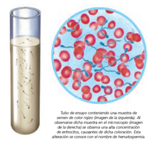 ¿Sabes cuál es el volumen, color y aspecto normal de un seminograma?