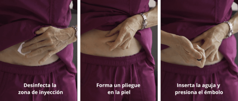 Administración de MERIOFERT KIT en Tratamientos de Fertilidad